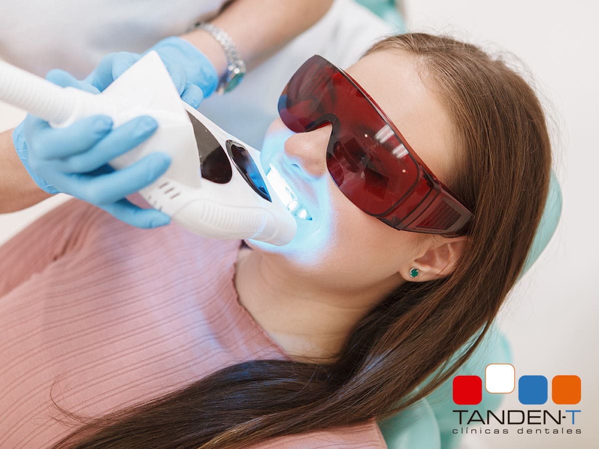 Odontología estética: es hora de sonreír con Tanden-t 😁